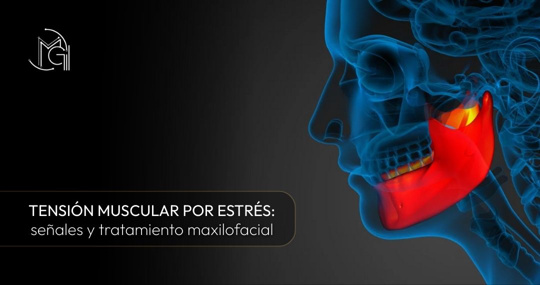 ¿Tensión muscular por estrés? Causas y cómo tratarla